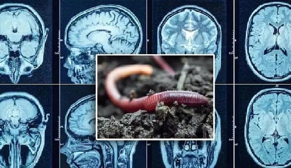 Live worm found in Australian woman's brain in world first ...